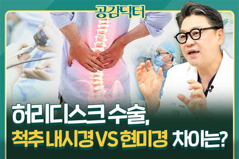허리디스크 수술 반드시 필요한 경우는 척추 현미경vs내시경 수술 비교 공감닥터 당신의 건강가이드 헬스조선