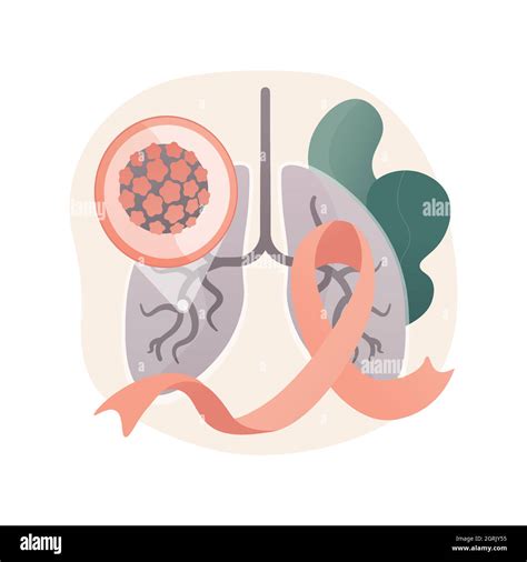 Lung Cancer Abstract Concept Vector Illustration Stock Vector Image And Art Alamy