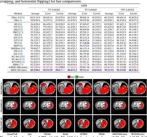 Table 5 From Rethinking Semi Supervised Medical Image Segmentation A Variance Reduction