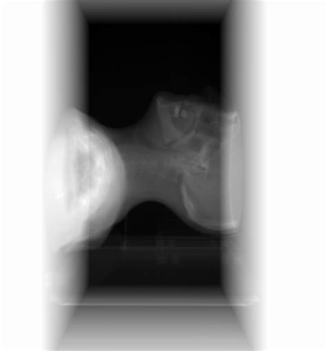 Itk To Rtk Migration Forward Projection Issuesquestions Algorithms Itk