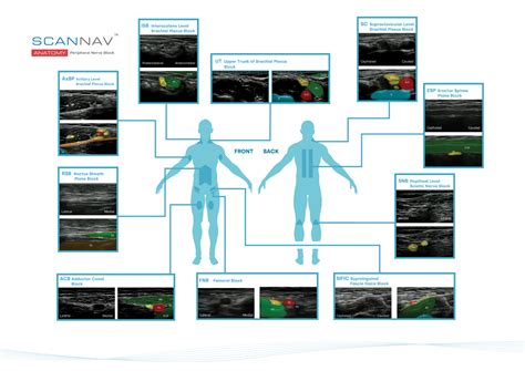 Artificial Intelligence For Ultrasound Scanning In Regional Anaesthesia