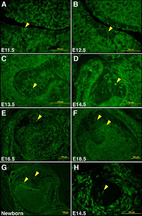 Figure 1 From Potential Contribution Of Neural Crest Cells To Dental