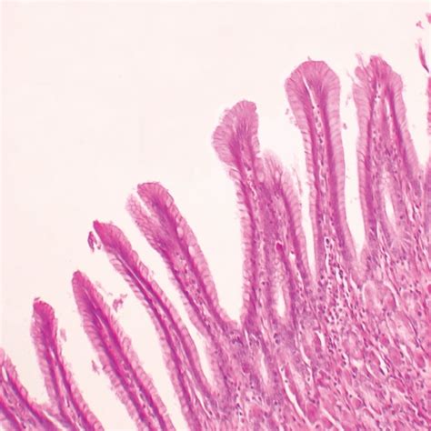Stomach Microscope Slide