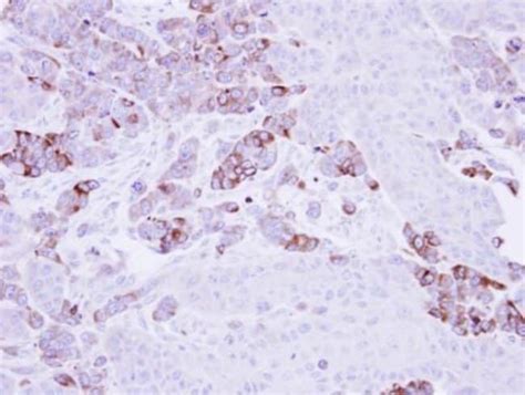 EPHX1 Polyclonal Antibody, Invitrogen 100 μL; Unconjugated:Antibodies ...