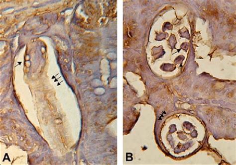 Lectin Histochemical Staining For Uea I Of 15 Hours Old A And Adult Download Scientific
