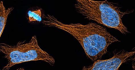 What Diffraction Limit If You Re Looking To Image Subcellular Detail At… Sinai Health