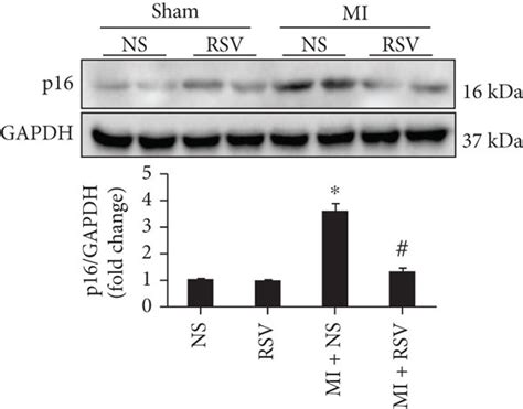 Rsv Decreased Expression Of Senescence Markers In The Mouse Heart
