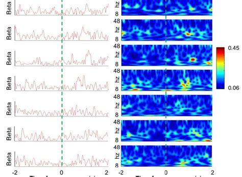 Human Motor Cortical Beta Bursts Relate To Movement Planning And Response Errors Dr James J