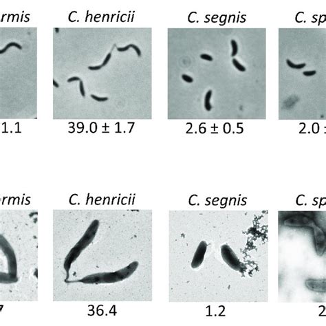 Stalk Formation Is Also Variable In Some Caulobacter Species
