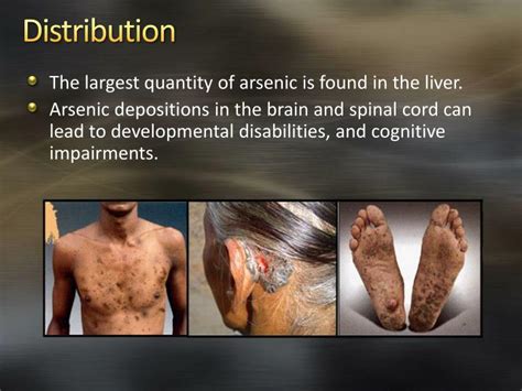 PPT Arsenic Poisoning PowerPoint Presentation ID