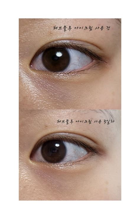 첫날에 사용했을 때 흡수가 잘 되는건가 이거 정말 효과가 있을까 반신반의 했어요 근데