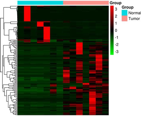 Identification Of Critical Pathways And Potential Key Genes In Poorly Ott