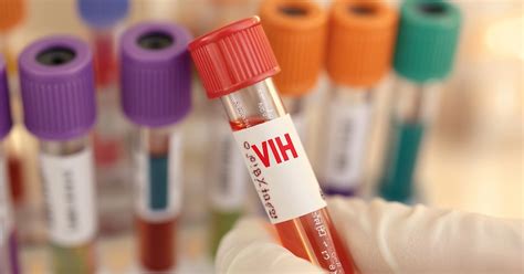 La Lucha Contra El Vih Está En Riesgo Por La Posible Retirada De Fondos