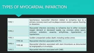 MYOCARDIAL INFARCTION Pptx