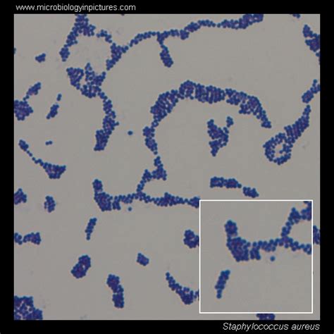 Staphylococcus Microscopy Staphylococcus Gram Stain And Cell Morphology Staphylococcus