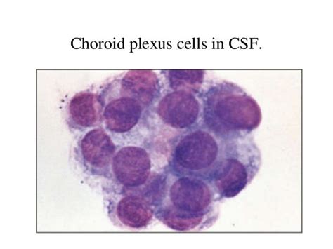 Fluid Cytology In Csf