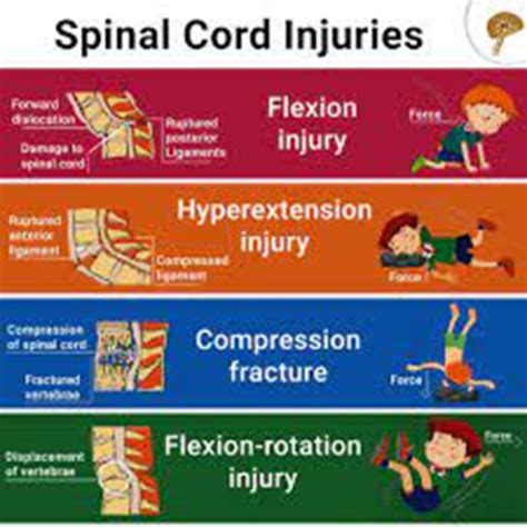 Extreme Neck Hyperextension Hyperflexion 1416 Youtube Ppt Chapter 50 Disorders Of Motor