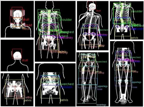 Examples From The Testing Data False Positive Detections Have Been Download Scientific Diagram