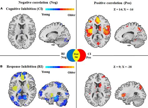 frontiers distinct neural activation patterns of age in subcomponents