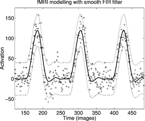 Fmri Time Series Measured In One Strongly Activated Voxel Voxel Download Scientific