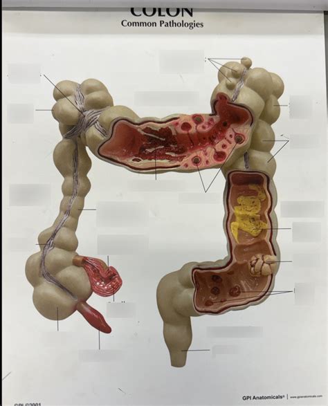 Colon Diagram Quizlet