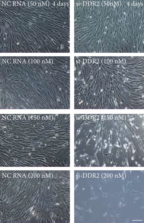 Inhibition Of Ddr2 Induced In Vitro Cellular Senescence And Dna Damage