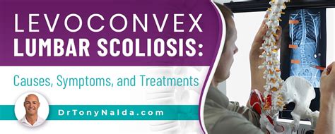 Levoconvex Lumbar Scoliosis Causes Symptoms And Treatment