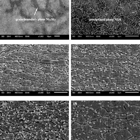 A Microstructure Of As Cast Cu Ni Si Alloy B Intragranular Download Scientific Diagram