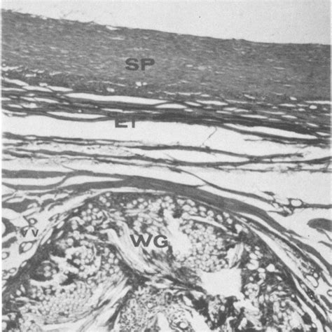 Section From A Control Graft Showing Thickened Subendothelial Layer Download Scientific Diagram