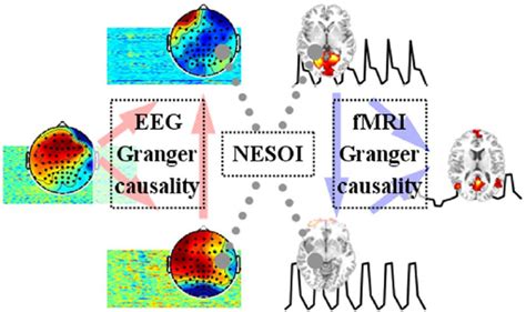 Illustration Of The Multimodal Functional Network Connectivity Download Scientific Diagram