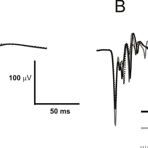 Lfp Reconstruction Based On Distance Left Lfp Measuring Electrode In