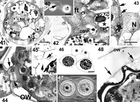 Sexual Reproduction And Mature Oospores 40 Phase Contrast Light