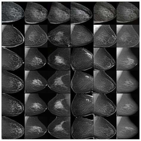 Applied Sciences Free Full Text Applying Deep Learning Methods For Mammography Analysis And