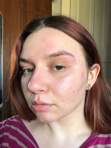 ОБЕРЕЖНО Почервоніння і недоліки бояться цього засобу Makeup Club