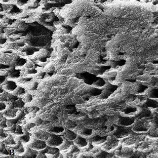 Enamel Etching Pattern Type 1 Honeycomb Appearance A Magnification Download Scientific