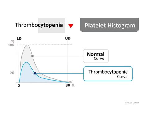 Updated Platelet Histogram