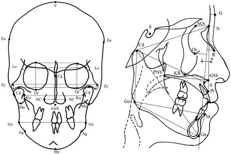 Cephalometric Tracing Template