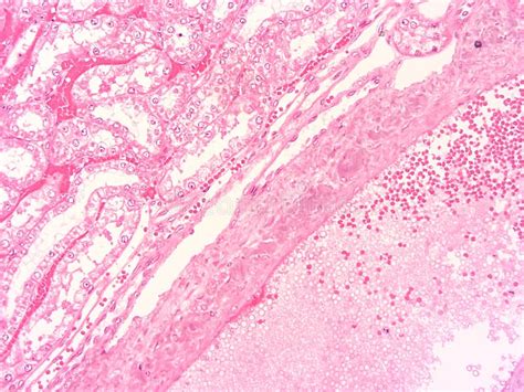 Histology Of Human Appendix Micrograph Showing Crypts Of Lieberkuhn Stock Image Image Of