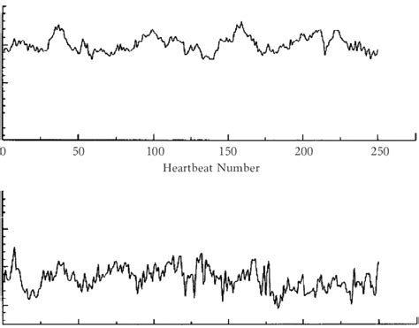 Heart Rate Sleeping At Dwayne Carson Blog