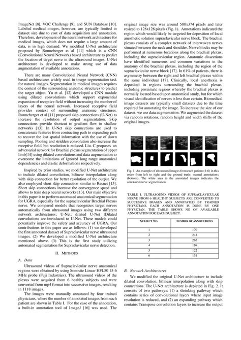 Automatic Ultrasound Image Segmentation Of Supraclavicular Nerve Using