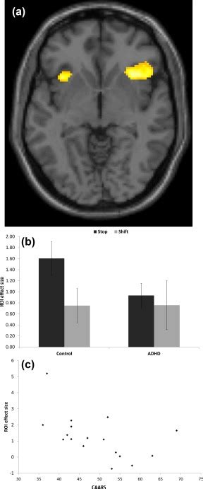 A Greater Activation For Stopping Relative To Shifting For All Download Scientific Diagram