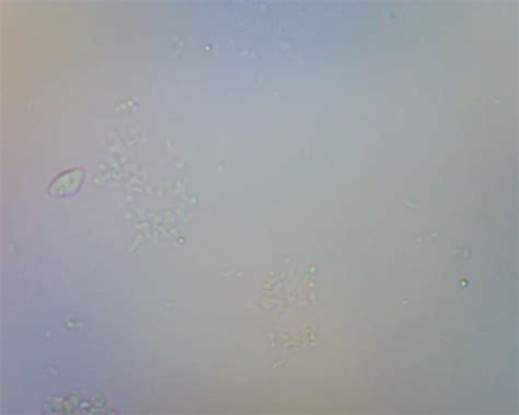 Protist Using Flagella To Forage R Microscopy