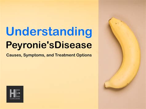 How Does Peyronies Disease Affect Sex Xoum