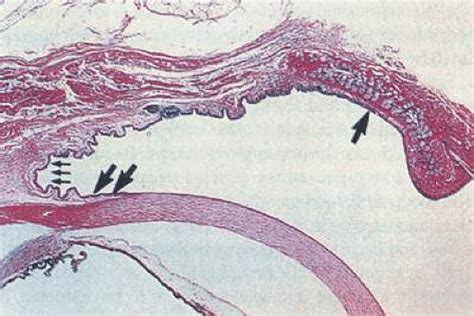 Conjunctiva Ento Key