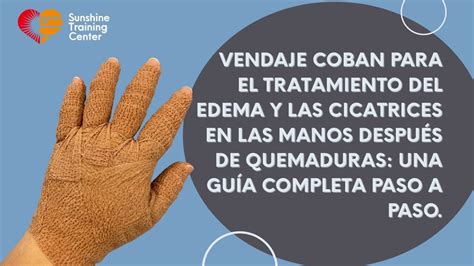 Vendaje Coban Para Edema Y Cicatrices En Las Manos Después De