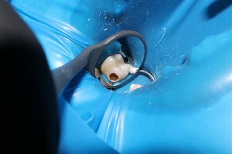 Page 4 900 Abscesses Pictures