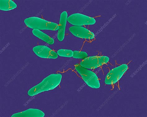 Clostridium Botulinum Bacterium Sem Stock Image C032 2635 Science Photo Library