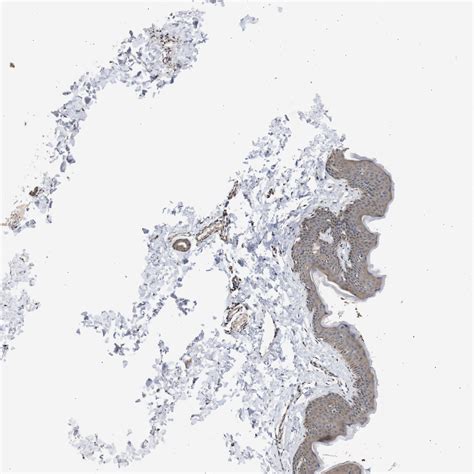 Tissue Expression Of Ddr1 Staining In Skin The Human Protein Atlas