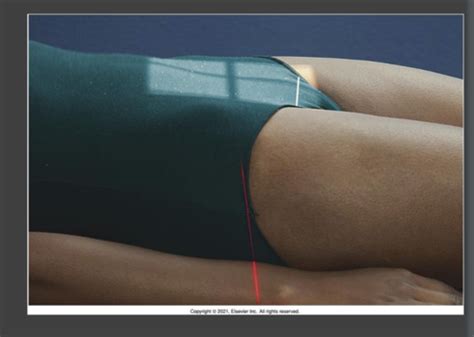 Unit Retrograde Procedures Of The Urinary System And Female Reproductive System Flashcards