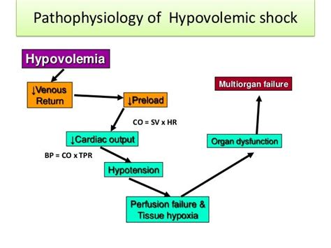 Shock Hypovolemic Septic And Neurogenic